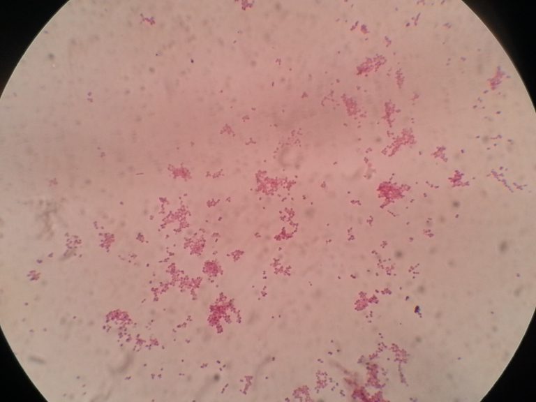 Kingella case report: Patient history, Lab diagnosis and treatment