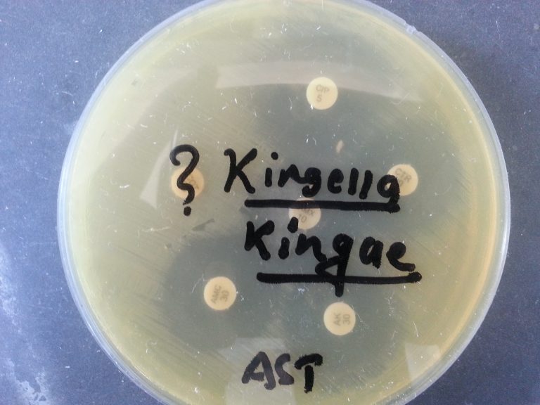 Kingella case report: Patient history, Lab diagnosis and treatment