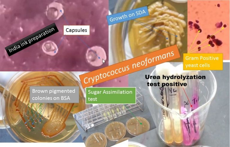 Cryptococcosis: Introduction,pathogenesis, laboratory diagnosis and treatm