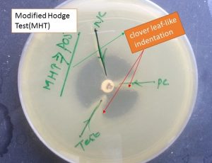 Modified Hodge Test for Carbapenemase detection: Principle, procedure