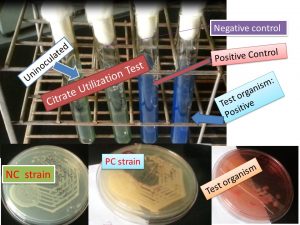 Citrate utilization test: Principle, procedure, result and ...