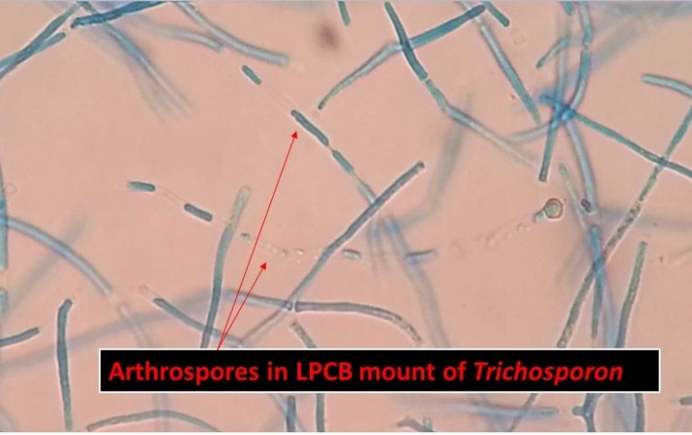 Arthrospores in LPCB Mount of Trichosporon: Introduction and Related Vid