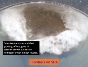 Bipolaris on SDA: Introduction, Classification, Clinical Features, Lab Dia