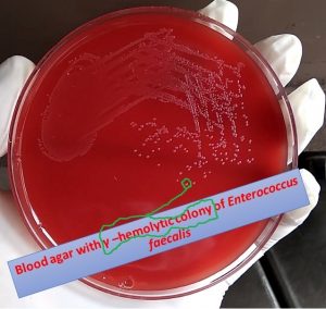 Blood agar with gamma hemolytic colony: Enterococci and their detail