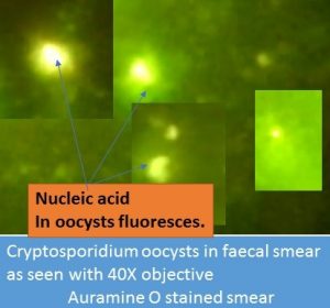 Cryptosporidium oocyts in Auramine stain: Introduction, Staining Procedure