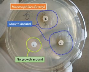 Haemophilus ducreyi : Introduction, Morphology, Pathogenesis, Lab Diag