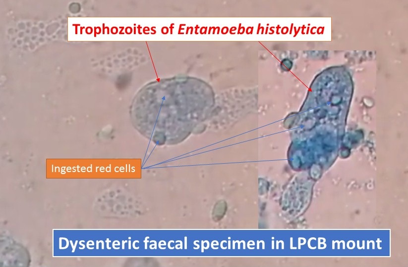 Entamoeba Trophozoites Under Microscope Entamoeba Trophozoites Under Microscope