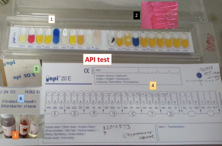 API Test For Bacteria Introduction Principle Test Procedure Result