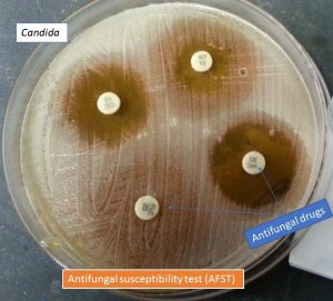 Antifungal drugs Susceptibility Testing: Introduction, Mode of action, Test