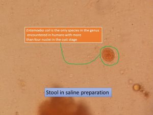 Entamoeba coli: Introduction, clinical presentation,Life cycle, Lab ...