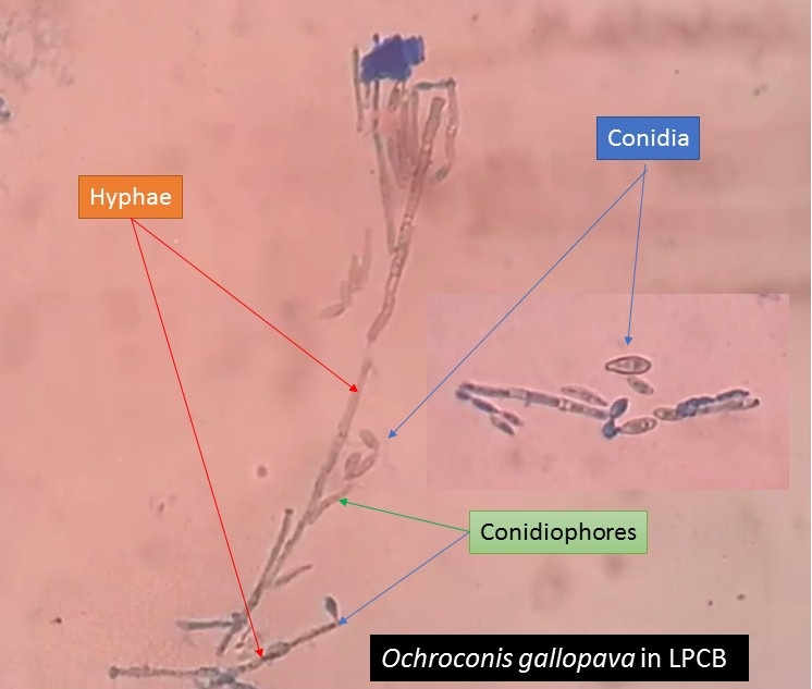 Ochroconis gallopava in LPCB preparation and Its Related