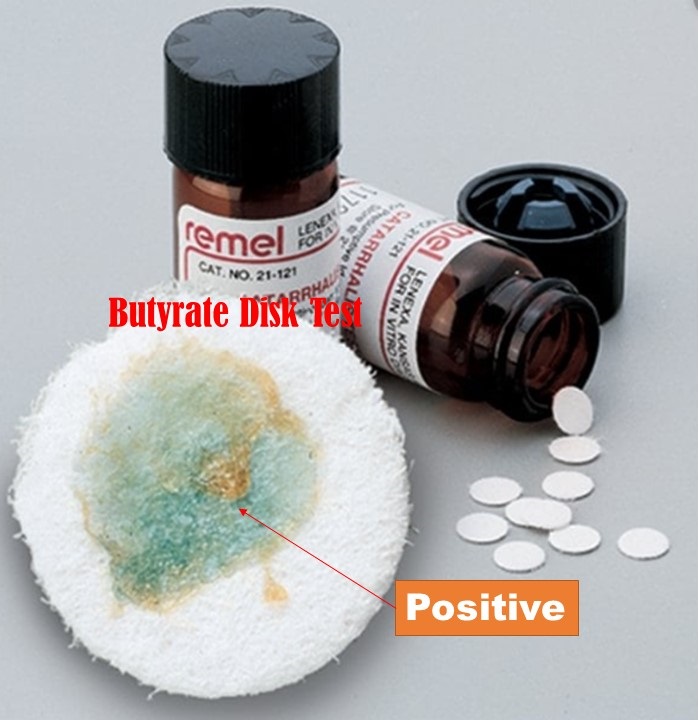 Butyrate Disk Test: Introduction, principle, procedure, result and ...