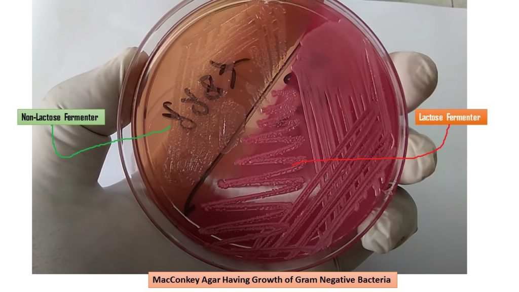 MacConkey Agar Introduction Principle Composition Preparation Pro MacConkey Agar Introduction Principle Composition Preparation Pro