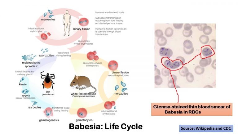 Babesia: Introduction, Morphology, Pathogenecity, Laboratory Diagnosis