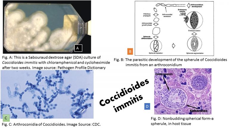 Coccidioides immitis : General Characteristics, Pathogenesis, Clinical Find