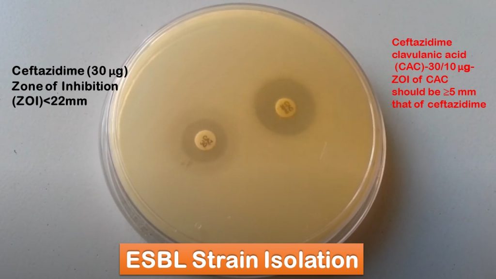 Extend Spectrum Beta Lactamase ESBL Strain Of Escherichia Coli Isolatio
