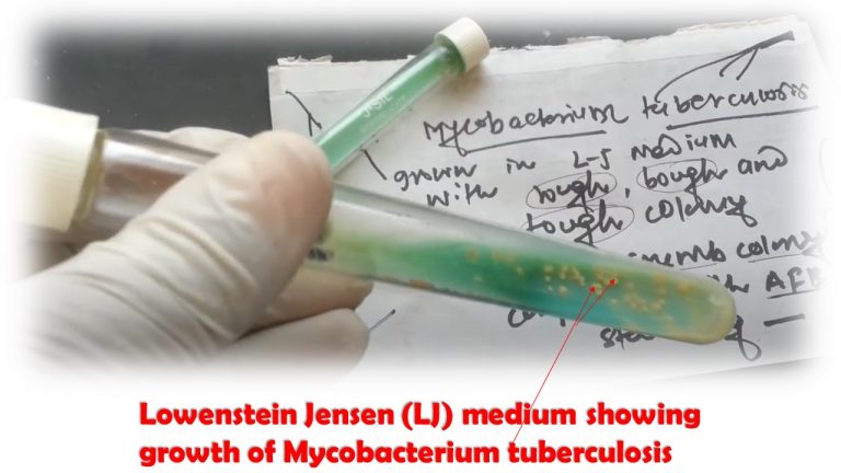 Lowenstein Jensen Medium: Introduction, Coposition, Preparation, Proced