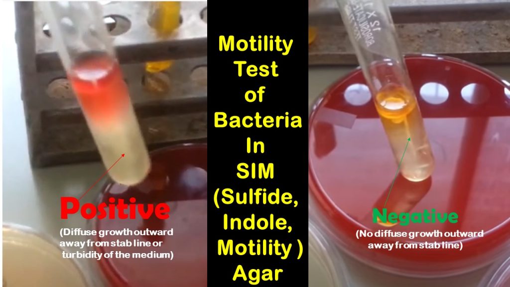 Bacterial Motility Test Principle Test Requirements Procedure Result
