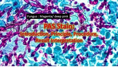 Periodic acid Schiff’s (PAS) Stain: Introduction, Principle, Procedure ...