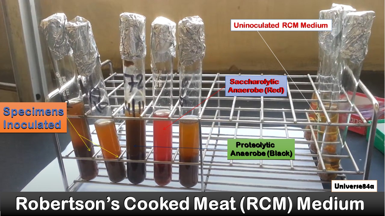 Rcm Introduction Principle Composition Preparation Test Procedure