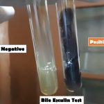 Principle of Bile Esculin test Archives - universe84a