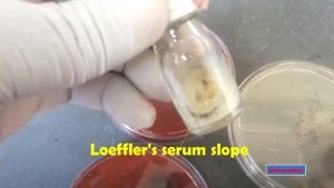 Loeffler Serum Slope: Introduction, Principle, Composition, Preparation