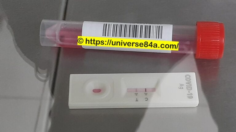 Lungene COVID-19 Antigen Rapid Test-Introduction,Principle, Test Requi