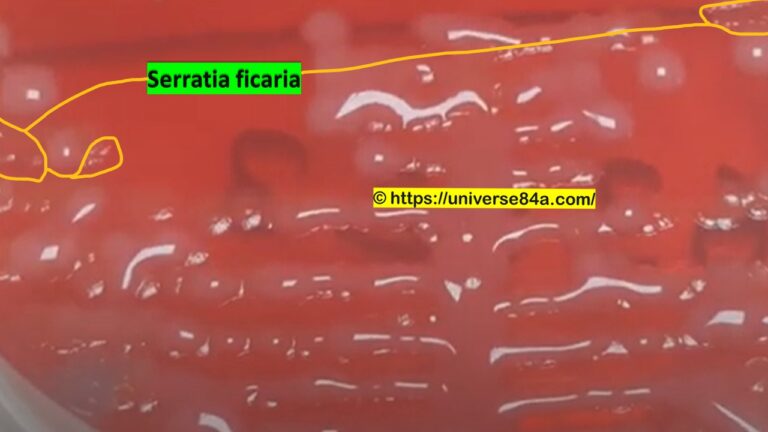 Serratia ficaria: Introduction, Morphology, Pathogenicity, Lab Diagnosis