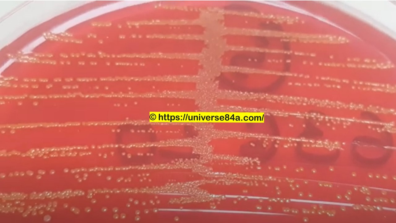Staphylococcus Lentus Introduction Morphology Pathogenicity