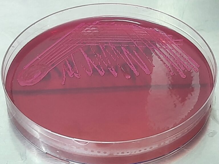 Staphylococcus haemolyticus- Introduction, Morphology, Pathogenicity