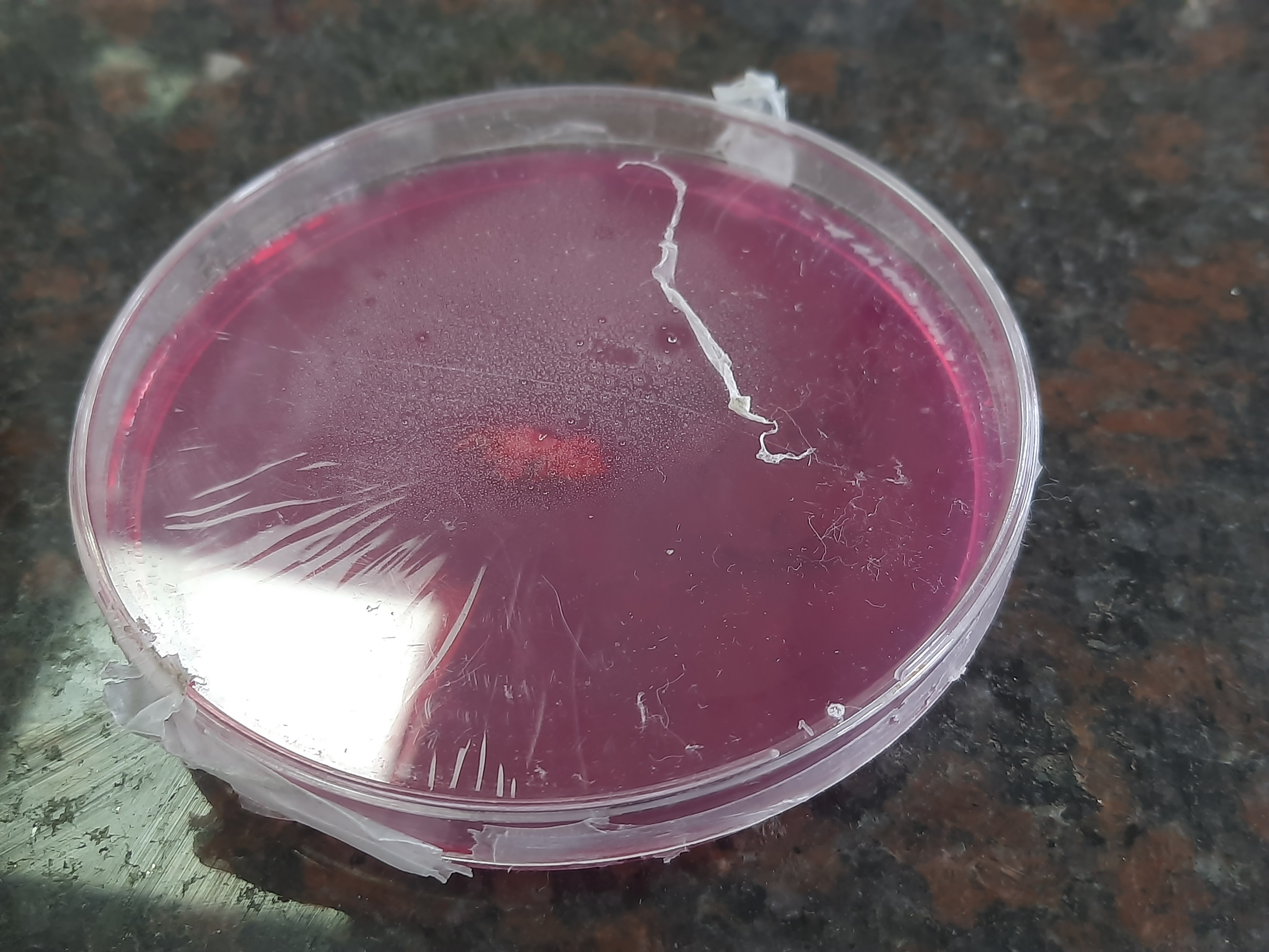 Rose Bengal Agar (RBA)- Introduction, Principle, Composition, Test