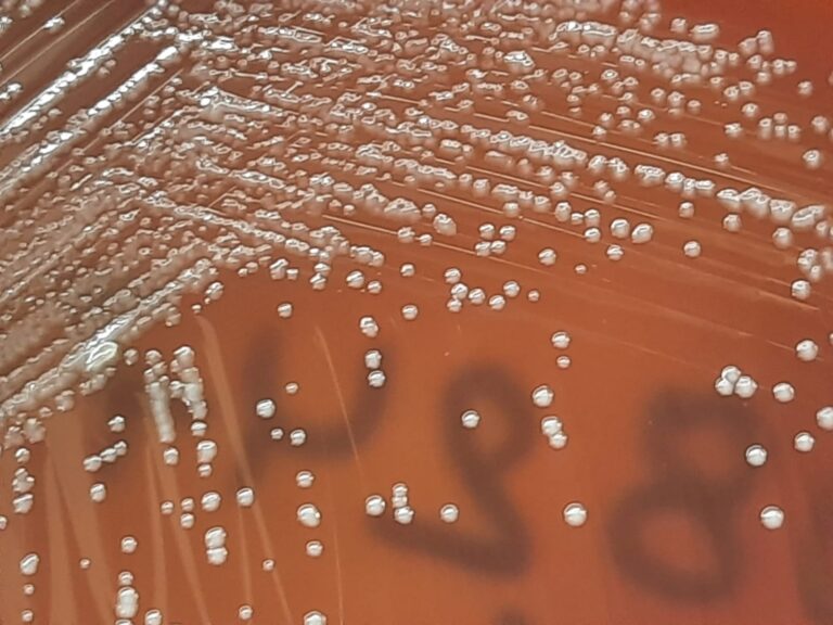 Acinetobacter ursingii: Introduction, Morphology, Pathogenicity